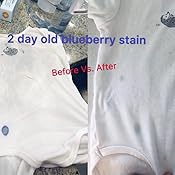 Nellie's WOW Stick Stain Remover: Amazon.ca: Health & Personal Care