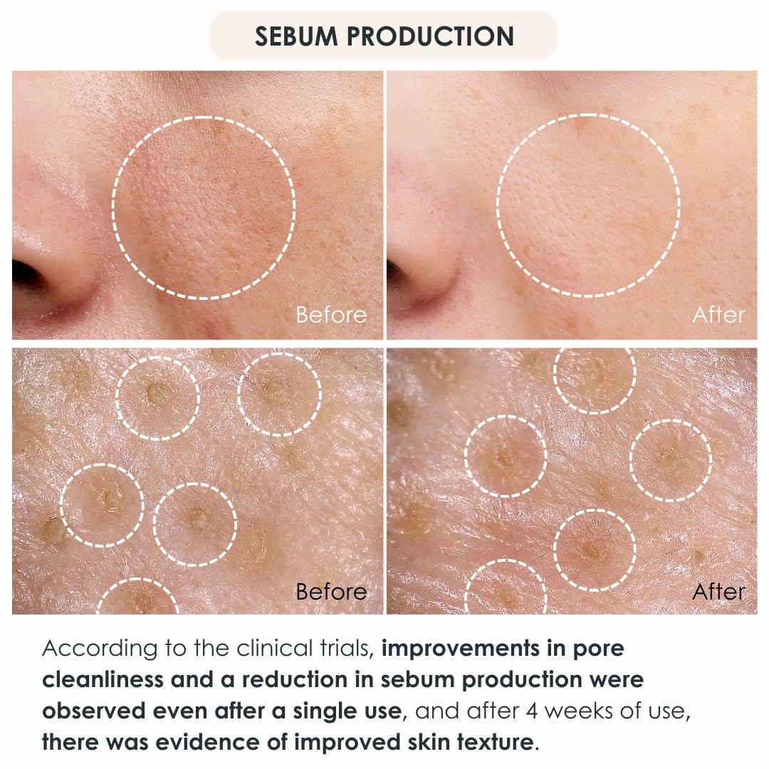 Mua Fleuri Clear Gel Cleanse - Exfoliating Gel Cleanser, Pore ...