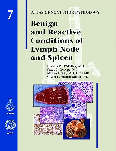 Benign and Reactive Conditions of Lymph Node and Spleen (Atlas of ...