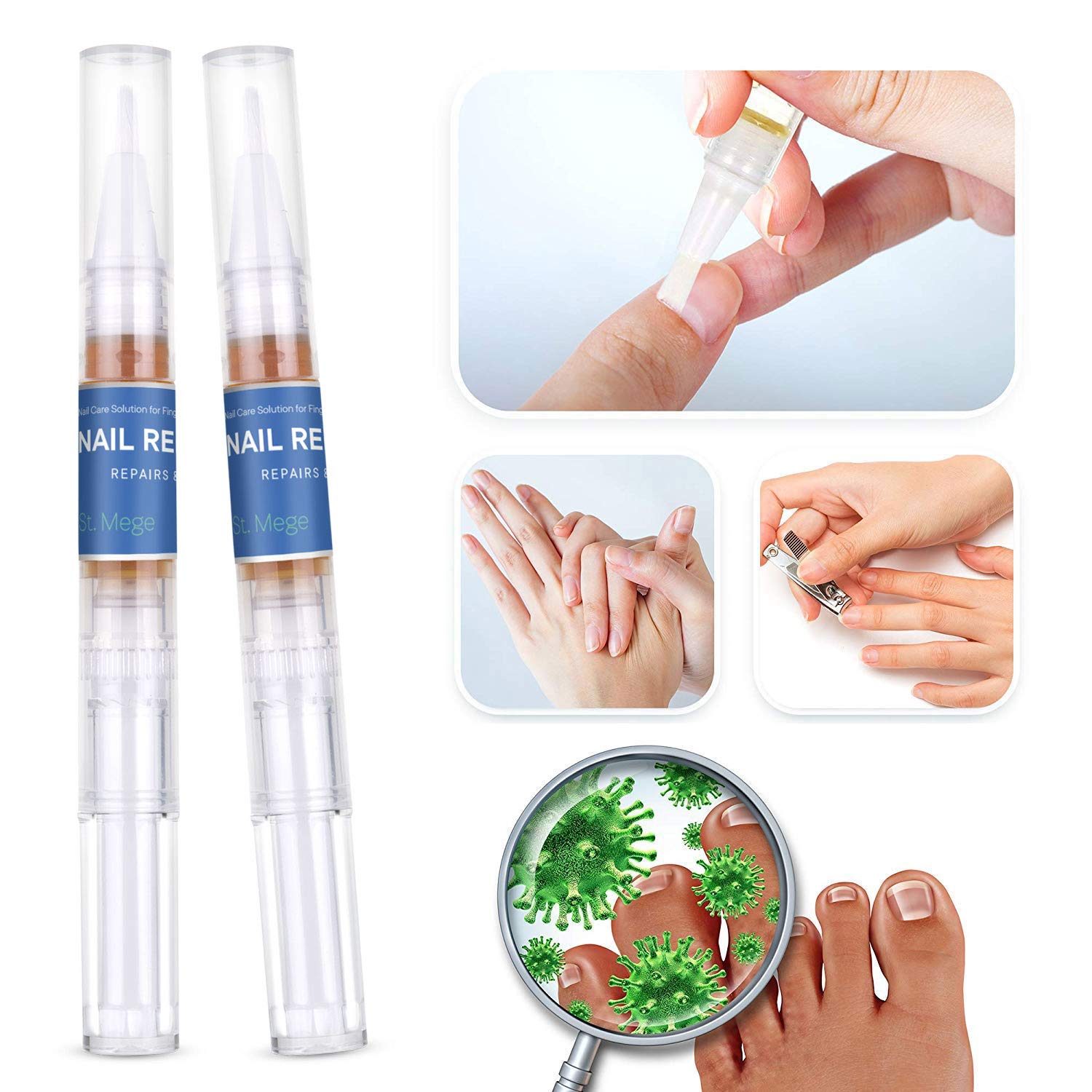St. Mege Fungus Nail Repair Pen, Natural Fungal Nail Care Solution for ...
