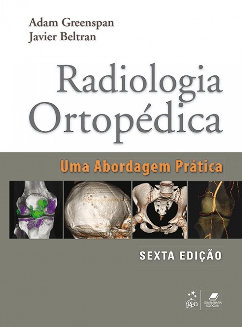 Radiologia Ortopédica - Uma Abordagem Prática PDF Adam Greenspan ...