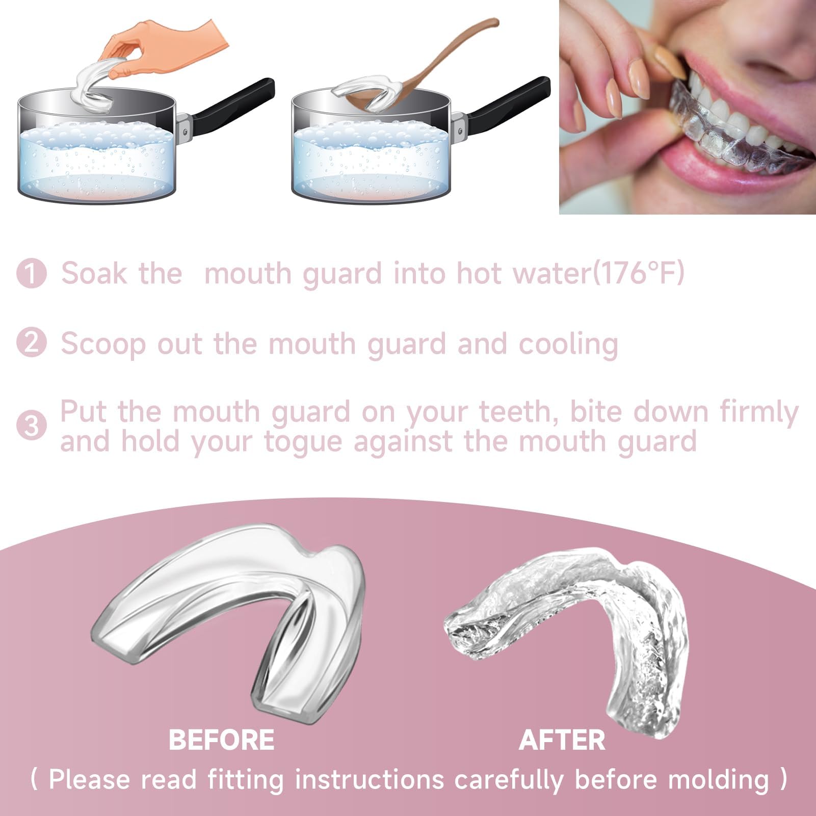 Mua 4 Pack Pink Night Guard for Women Teeth Grinding, Medium Size ...
