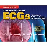 The Complete Guide to ECGs: .: 9780763764050: Medicine & Health Science ...