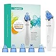 Amazon.com: VOYOR Blackhead Remover Pore Vacuum - Electric Face Vacuum Pore Cleaner Acne White ...