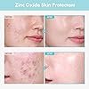 TOSOWOONG Zinc Oxide 10 Cream, 100,000ppm Zinc Oxide, Heal, Soothe Acne ...