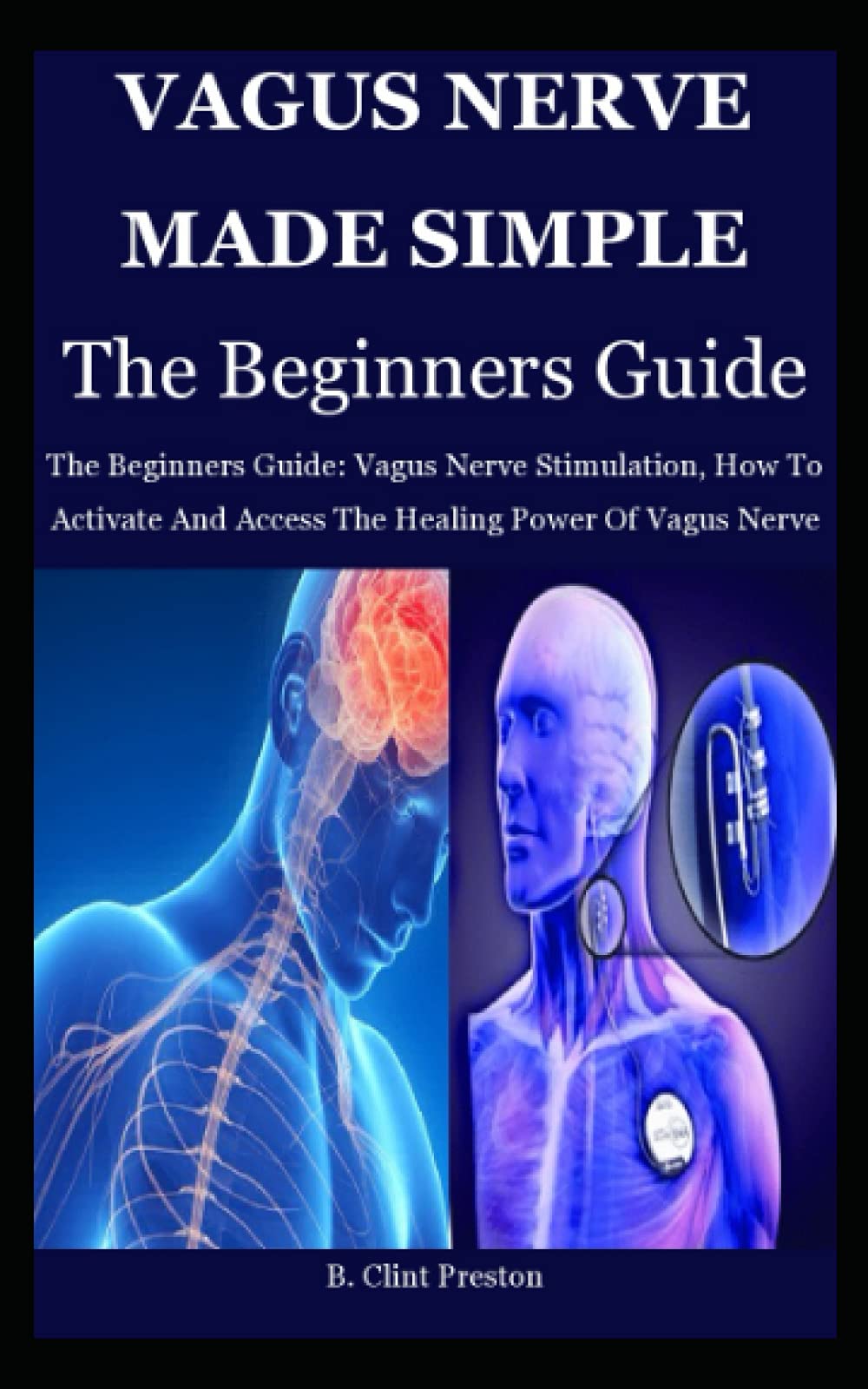 VAGUS NERVE MADE SIMPLE: The Beginners Guide: Vagus Nerve Stimulation, How To Activate And ...