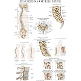 Palace Learning Anatomy of the Spine Poster - Laminated Spinal Anatomical Chart - 18" x 24 ...