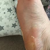 Footner Exfoliating Socks, Foot Mask, Foot Peel, At Home Pedicure to ...