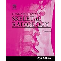 Fundamentals of Skeletal Radiology: 9780323611657: Medicine & Health ...