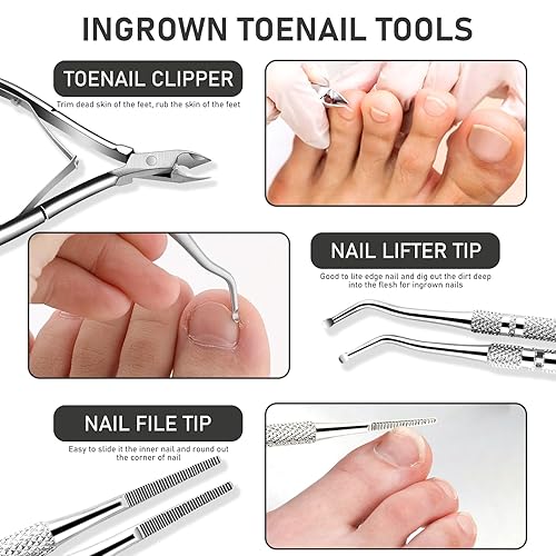 Ingrown Toenail Removal Tool Buy Stainless Steel Ingrown Toenail