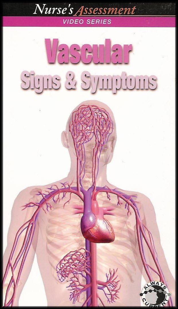 Amazon.com: Vascular Signs and Symptoms (Learn How To Assess Quickly ...