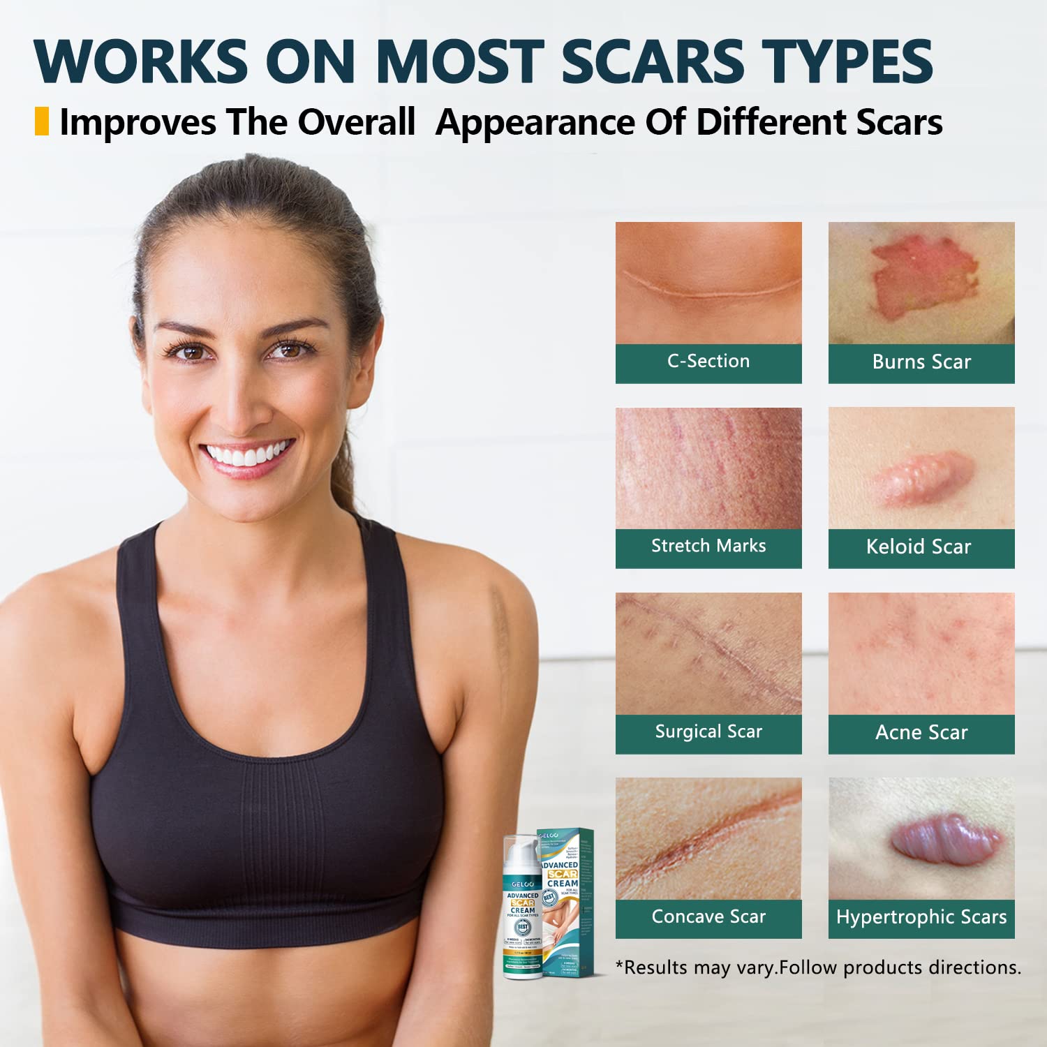 Mua Geloo Advanced Scar Cream Gel 50g - Silicone Gel Scar Removal ...