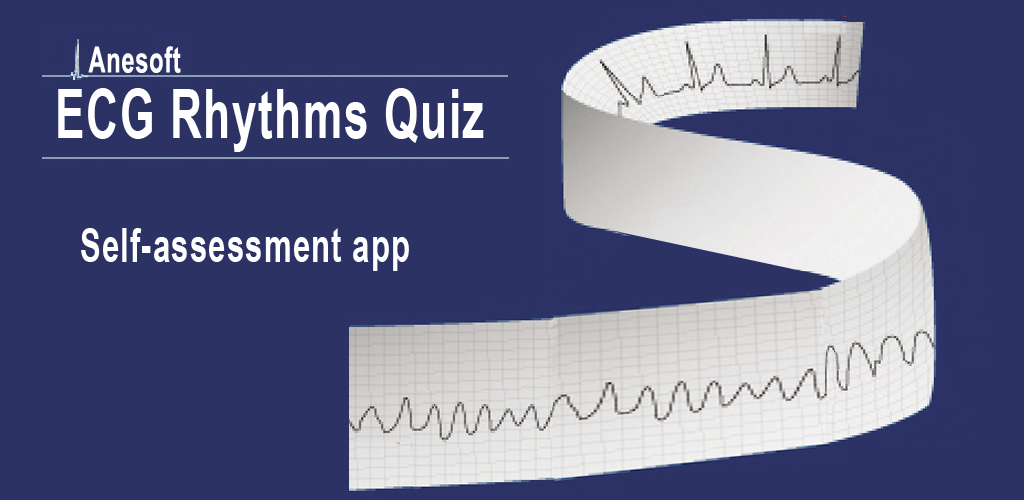 Amazon.com: ECG Rhythms Quiz : Apps & Games