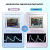 DAWEIanimed 12.1" Veterinary Vital Signs Monitor for Pets, Animal ECG ...