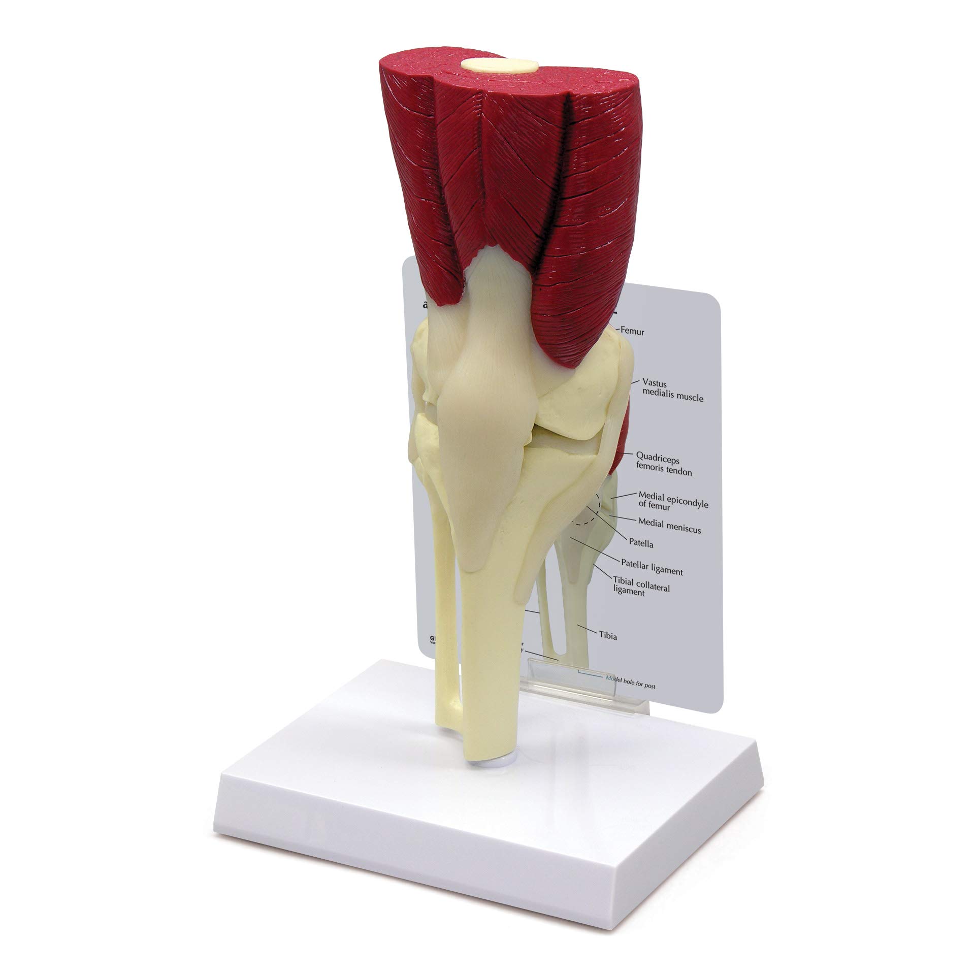 Mua GPI Anatomicals - Muscled Knee Model, Right Knee Joint with Muscles ...