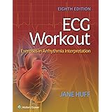 ECG Workout: Exercises in Arrhythmia Interpretation: Huff, Jane ...