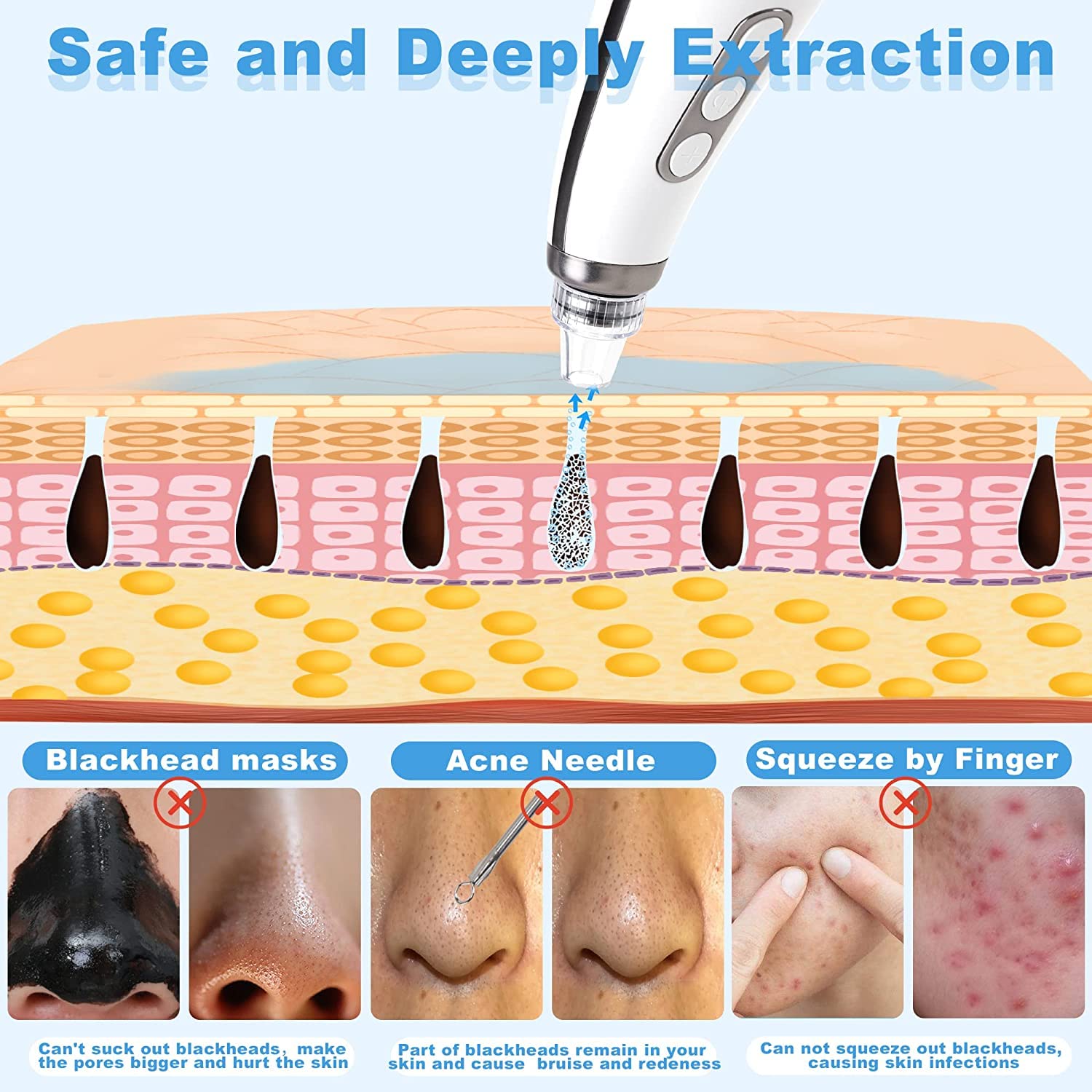 Mua Tibobo Blackhead Remover Tools Pore Vacuum, Blackhead Remover Kit ...