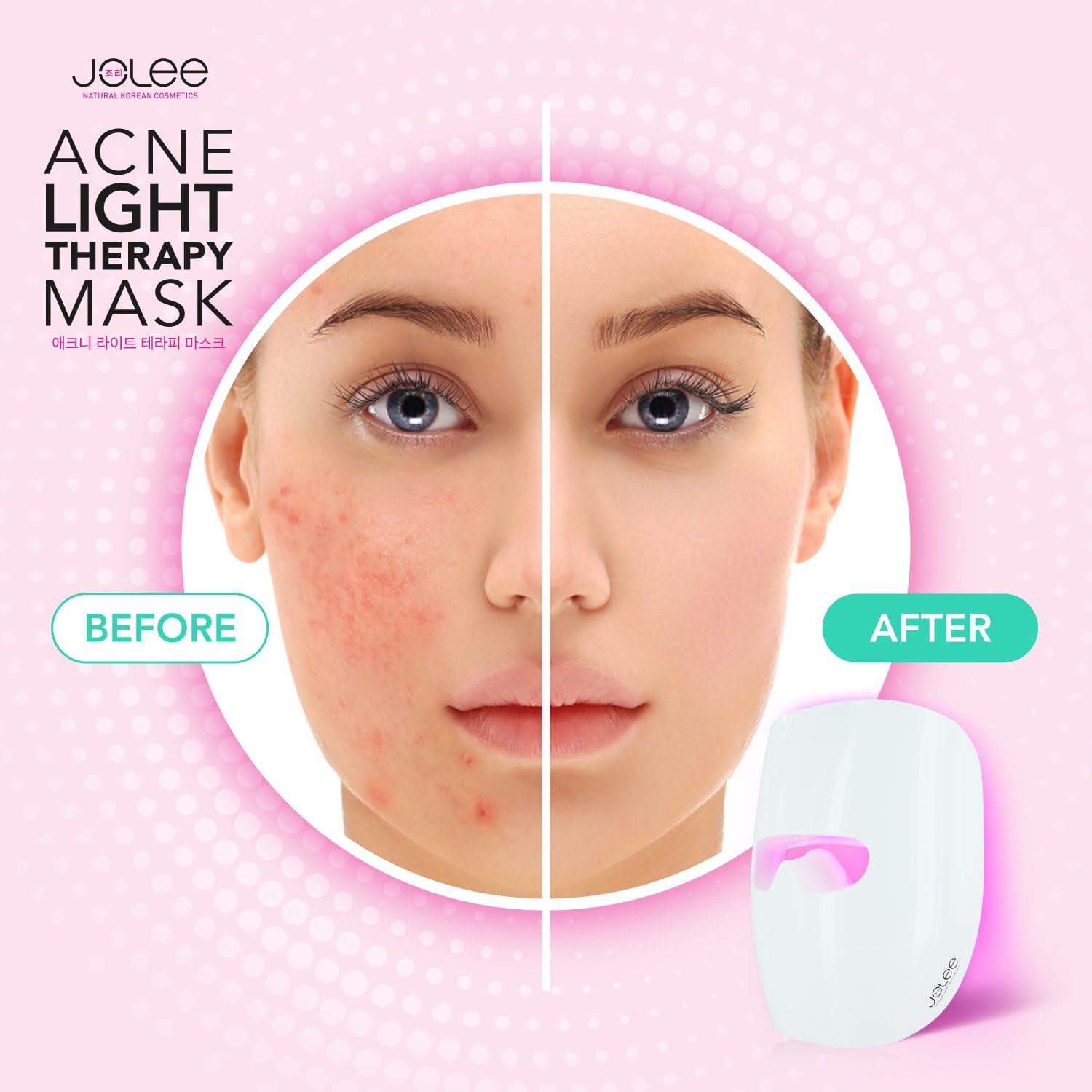 Los 10 limpiadores de acné más vendidos – 🔎 epiniones.com