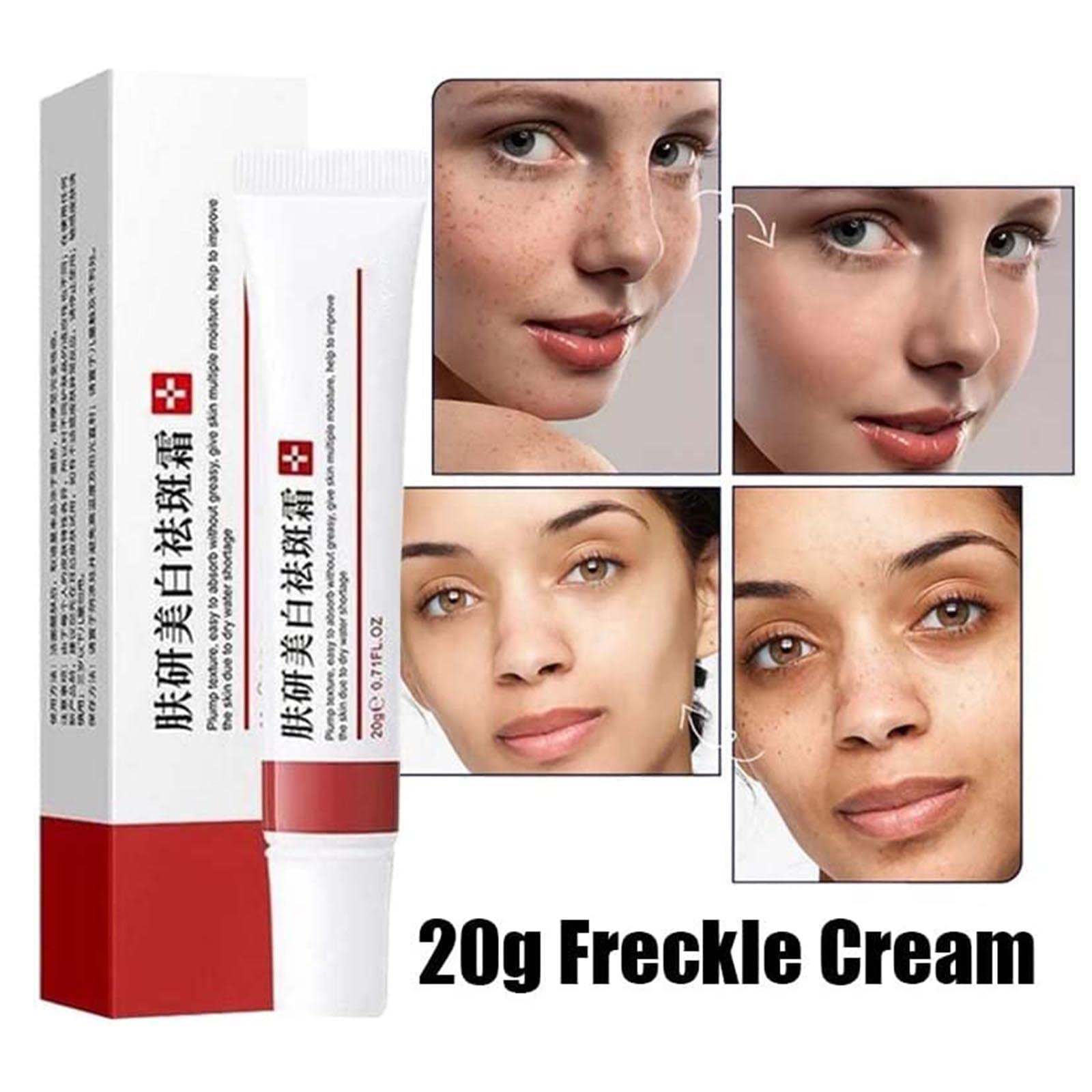 Mua Spot-Off Freckle Whitening Cream, Effective Whitening Freckle Cream ...