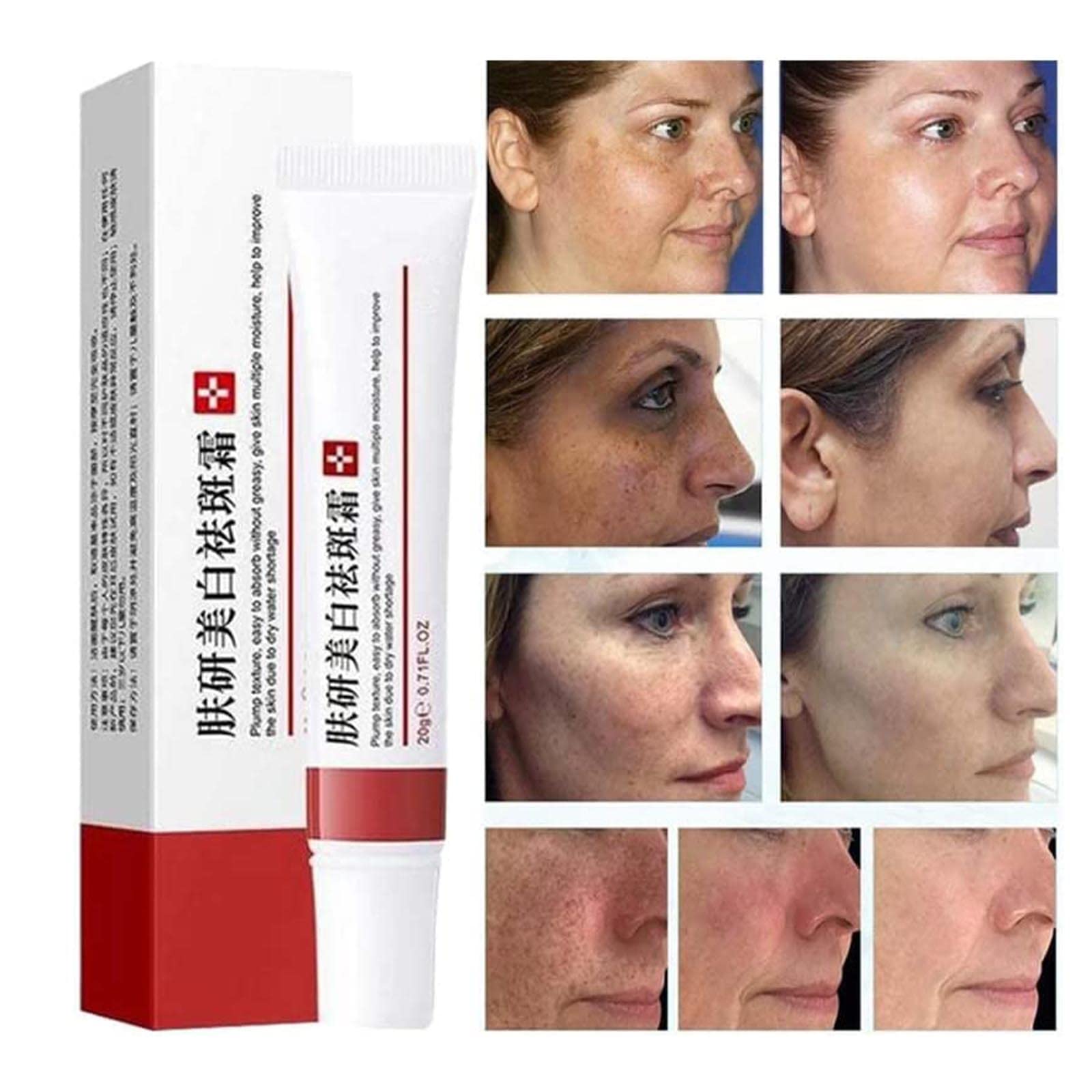 Mua Spot-Off Freckle Whitening Cream, Effective Whitening Freckle Cream, Blemish Recovery Cream ...