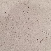 LiceGuard Robi Comb Electronic Lice Comb: Amazon.ca: Home & Kitchen