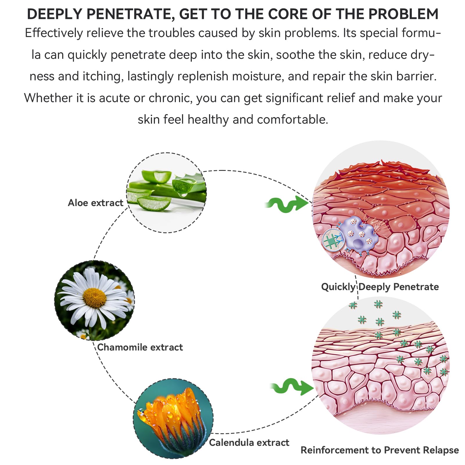 Mua 1 PCS Manuka Honey Tea Tree Drawing Salve Cream Ointment for Boil ...