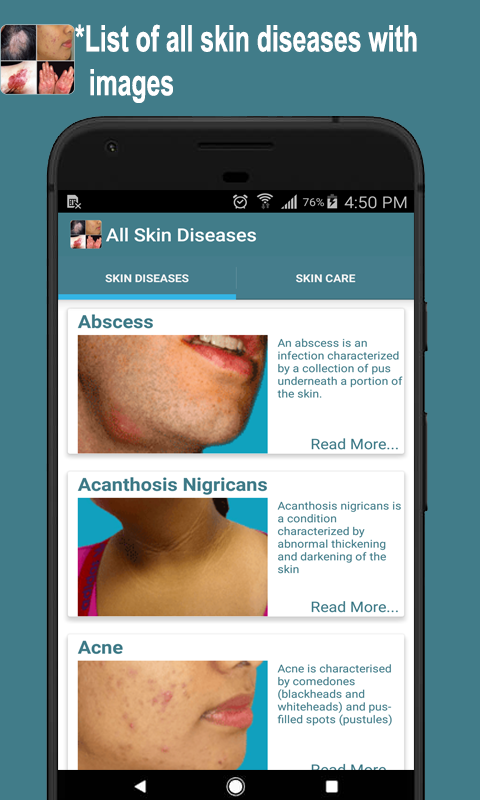 All Skin Diseases and Treatment A-Z:Amazon.com:Appstore for Android