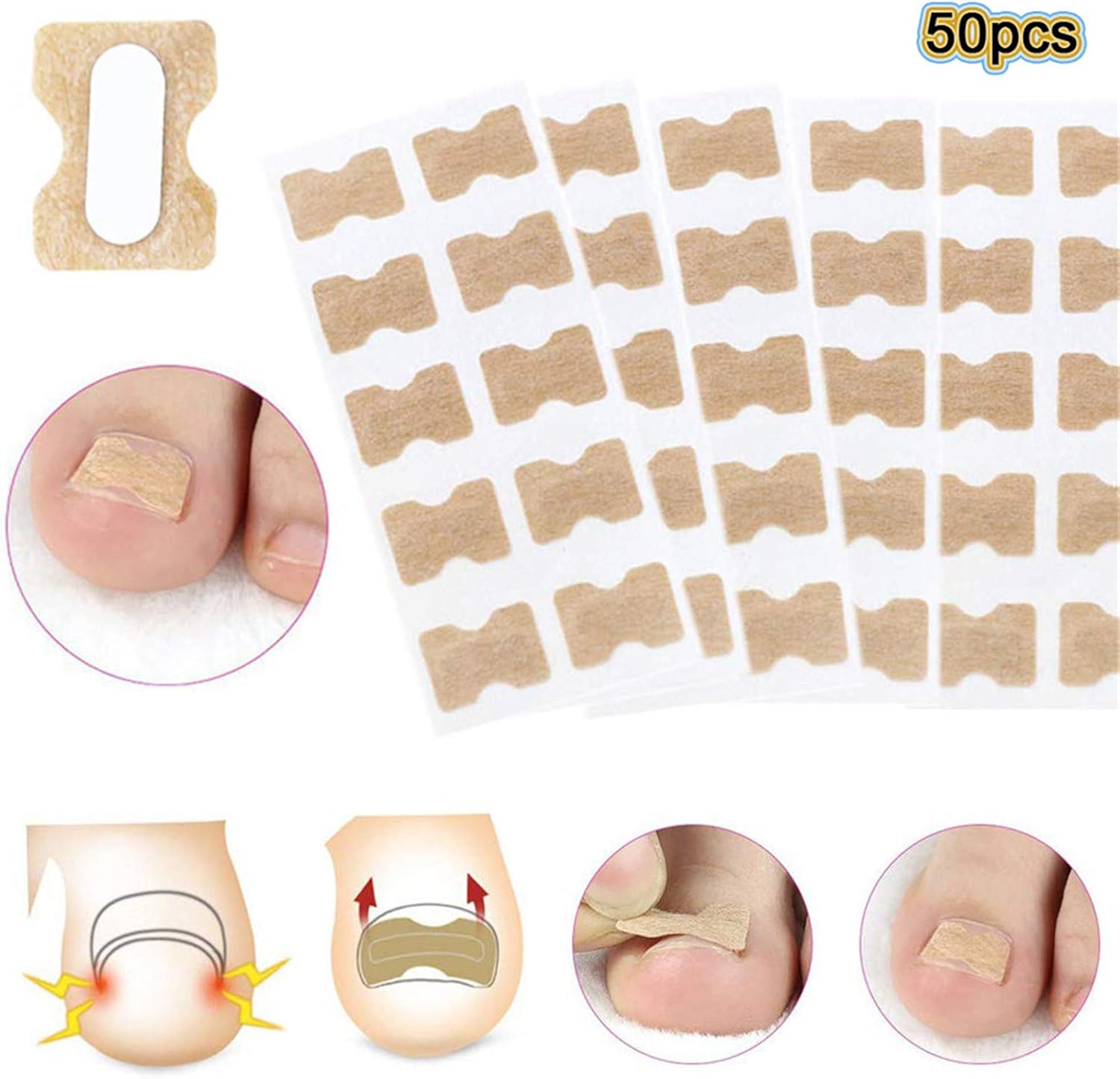 Ingrown Toenails Stickers, 50PCS Glue-Free Toenail Correction Patch ...