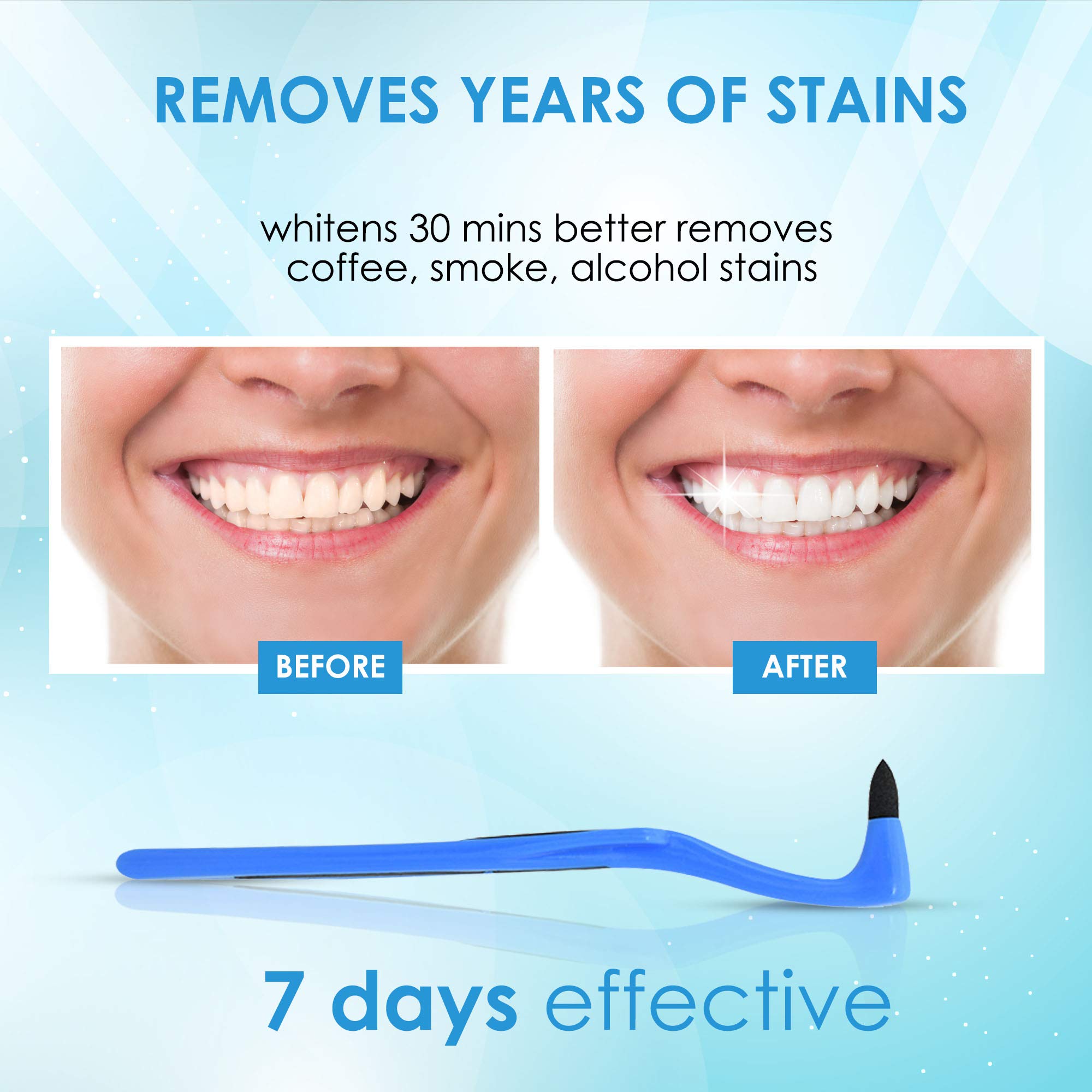 Teeth Stain Remover, Dental Plaque Eraser, Dentary Stains Scraper ...