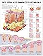 Skin and Common Disorders Anatomical Chart Unmounted: The Skin And ...