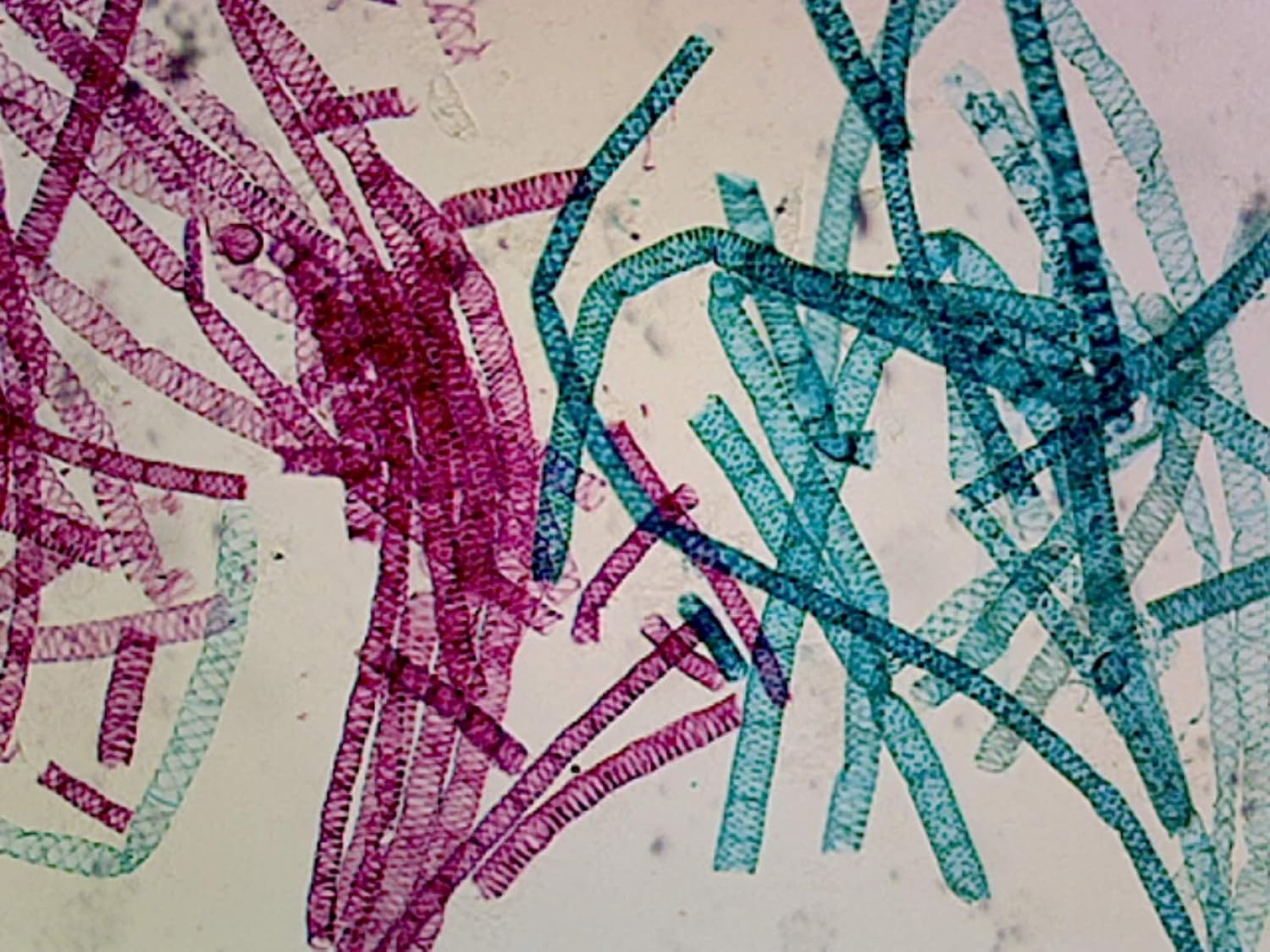 Microscope Slide Spirogyra Vegetative Chlorophyta tillescenter ...