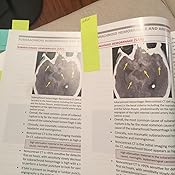 Core Radiology: A Visual Approach to Diagnostic Imaging: 9781107679689 ...