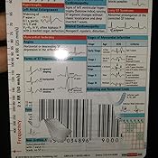 ECG Pocketcard: Amazon.it: Bbp: Libri in altre lingue