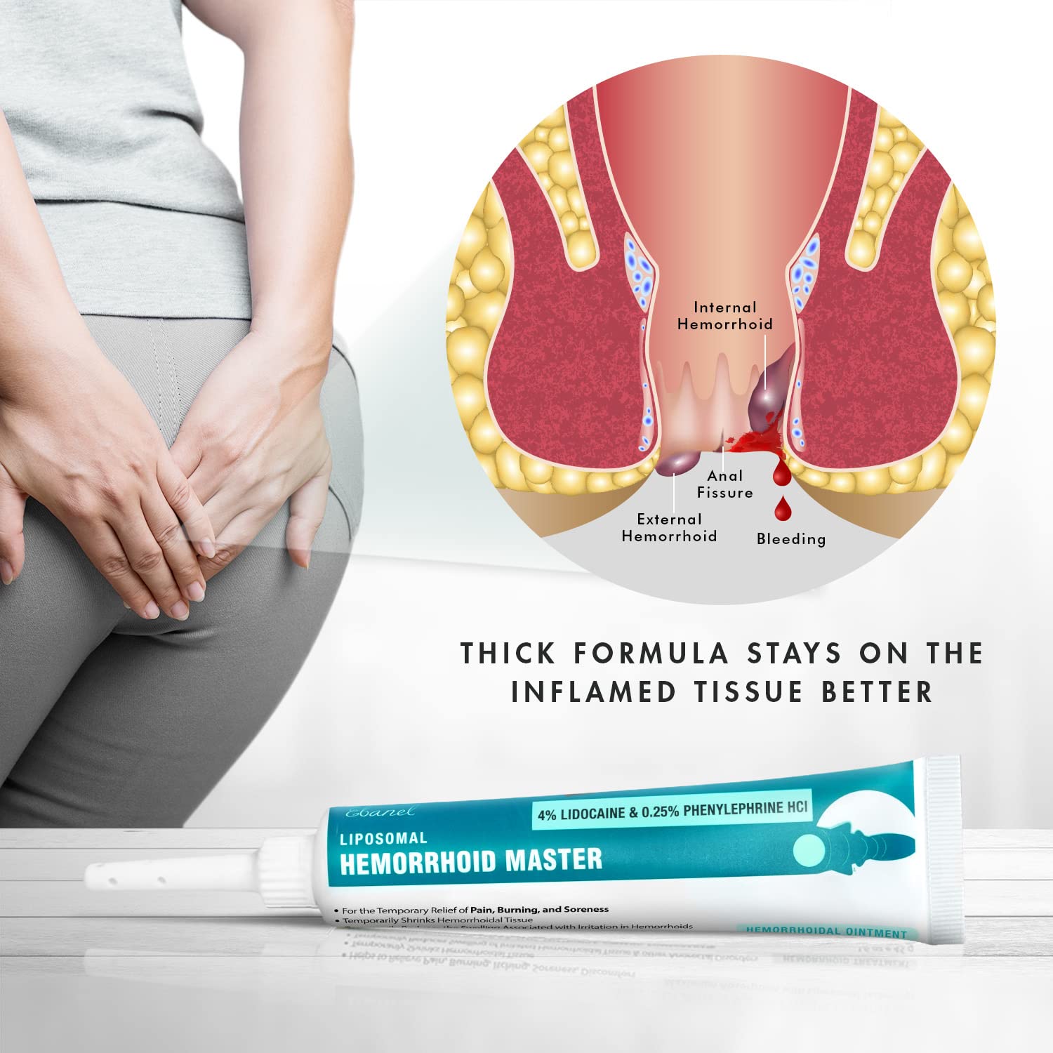 Mua Ebanel 4% Lidocaine Hemorrhoid Treatment Ointment with ...