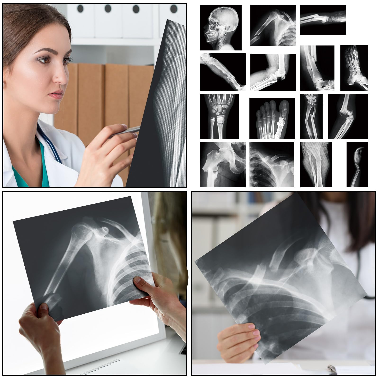 Mua Sayglossy Sayglossy 15 Pcs Broken Bones x Ray Set Human x Rays Black and White Skeleton ...