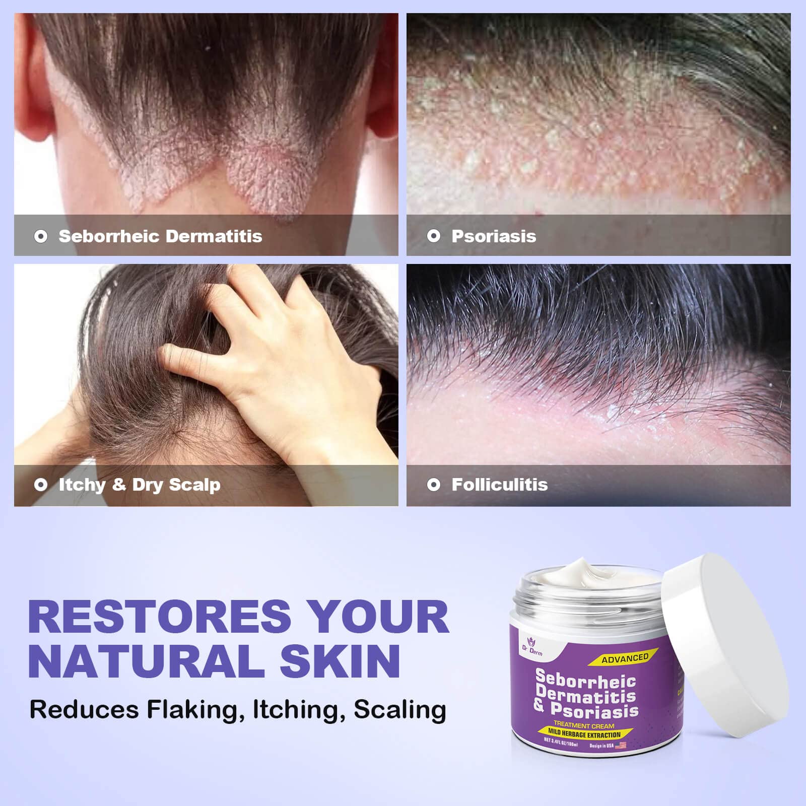 Mua DR. DERM Seborrheic Dermatitis Cream, Psoriasis Cream, Psoriasis ...
