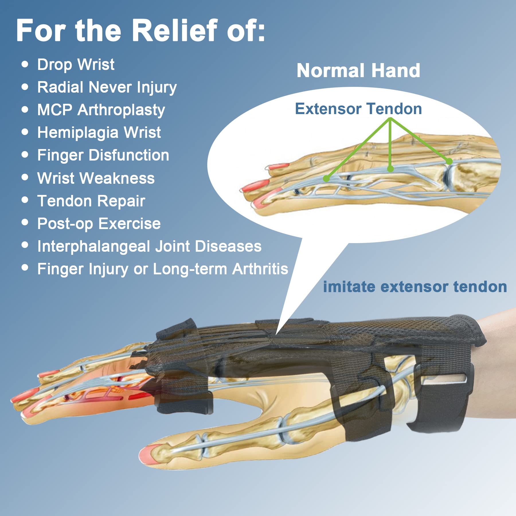 Mua Feamero Radial Nerve Palsy Splint, Adjustable Finger Lift Elastic ...