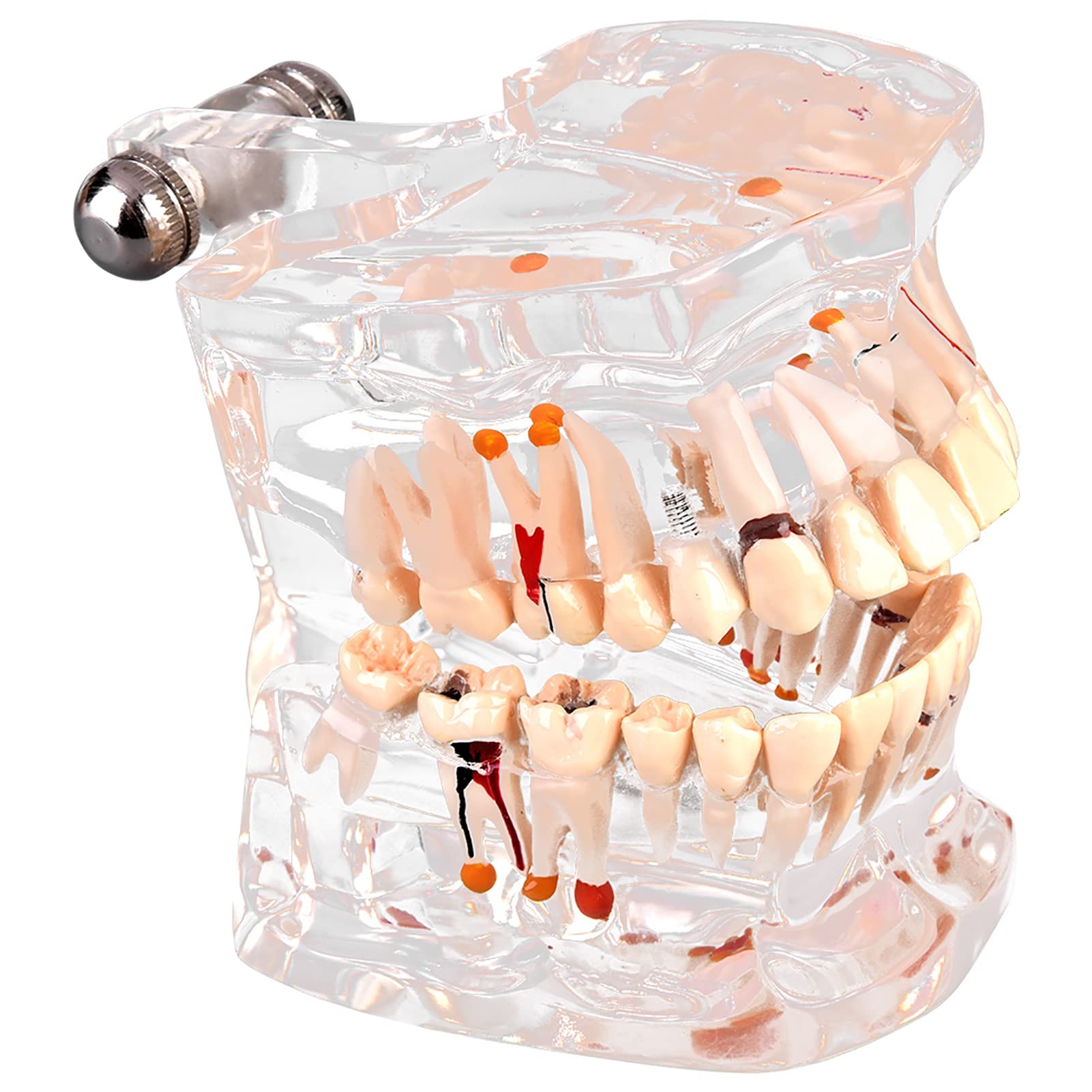 Mua Teeth Model Dental Model Mouth Model Transparent Gingival Tooth ...
