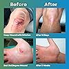 MediQuick Mist Skin & Wound Repair helps speed Healing Naturally with a ...