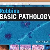 Robbins Basic Pathology: with STUDENT CONSULT Online Access (Robbins ...