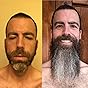 Amazon.com: The Beard Czar-Facial Hair Complex- Highly Effective Mens ...