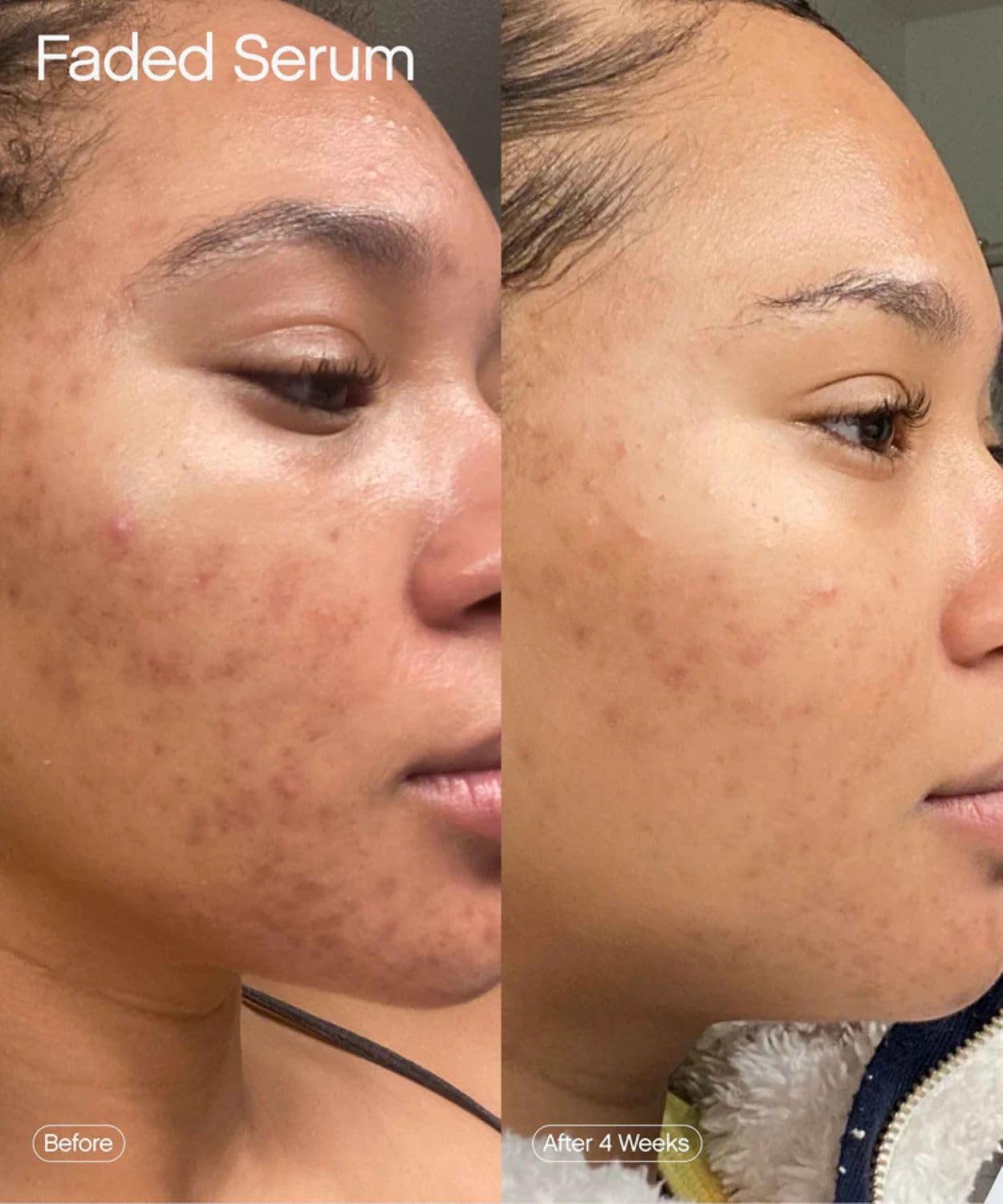 Mua Topicals Faded Brightening and Clearing Serum | Reduces ...