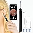 VITCOCO Ear Wax Removal, 1926P FHD Wireless Otoscope Earwax Removal ...