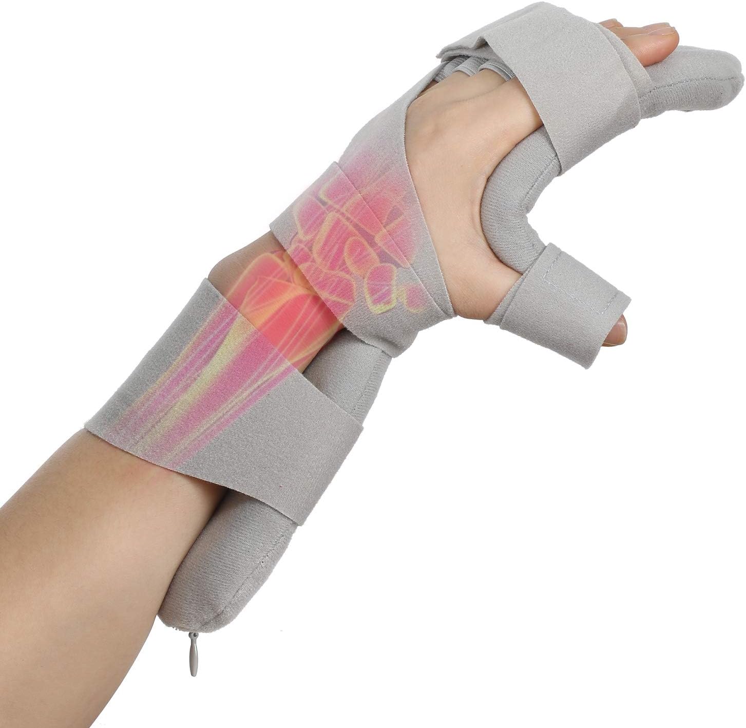 Hand Splint Functional Finger Orthosis, Soft Function Resting Hand ...