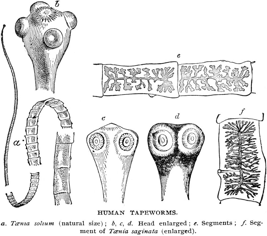 Tapeworms 19Th Century Nfigures A-E Represent Taenia Solium The Pork ...