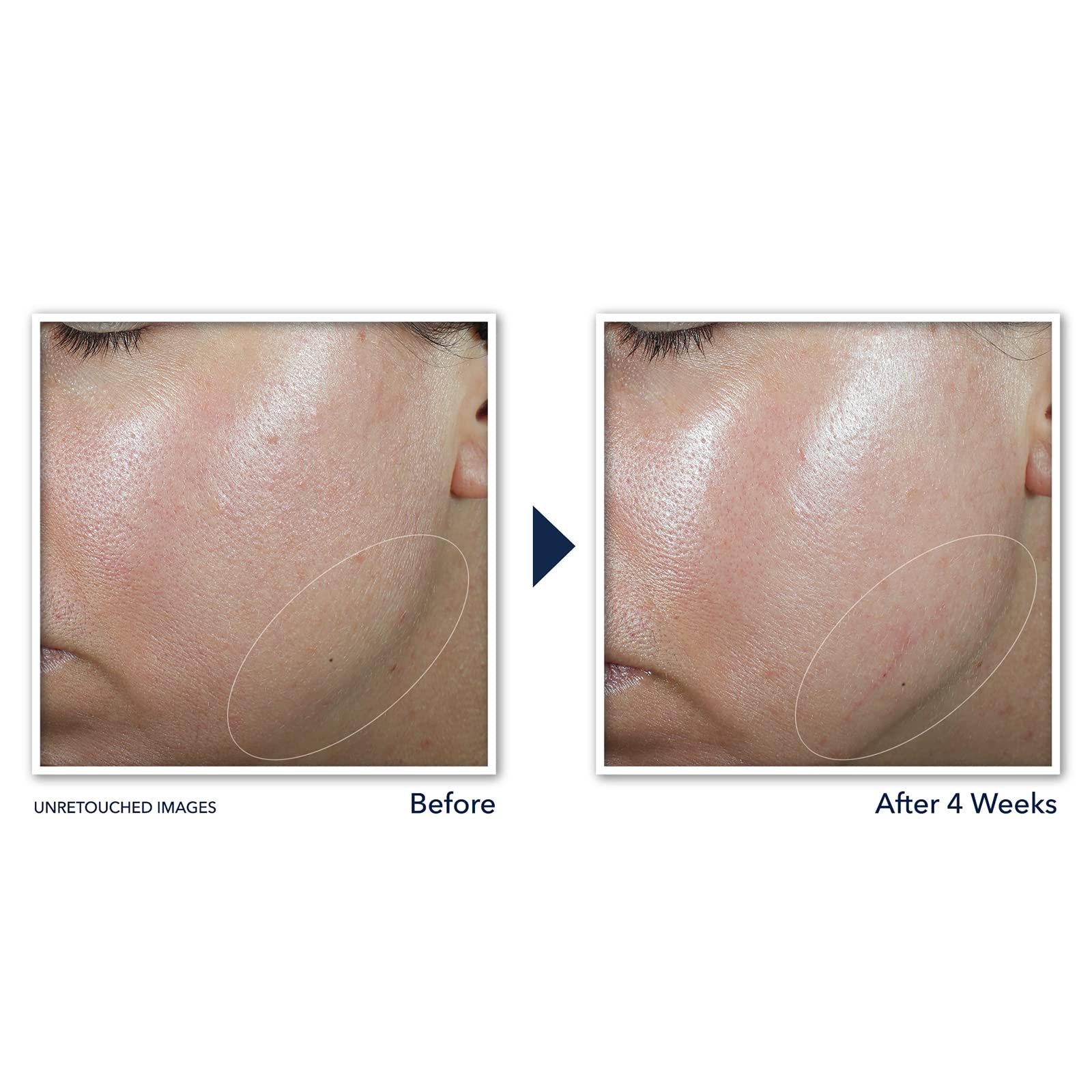 Mua Derm Correxion Neck Cream with Hyaluronic Acid and Advanced Retinol ...