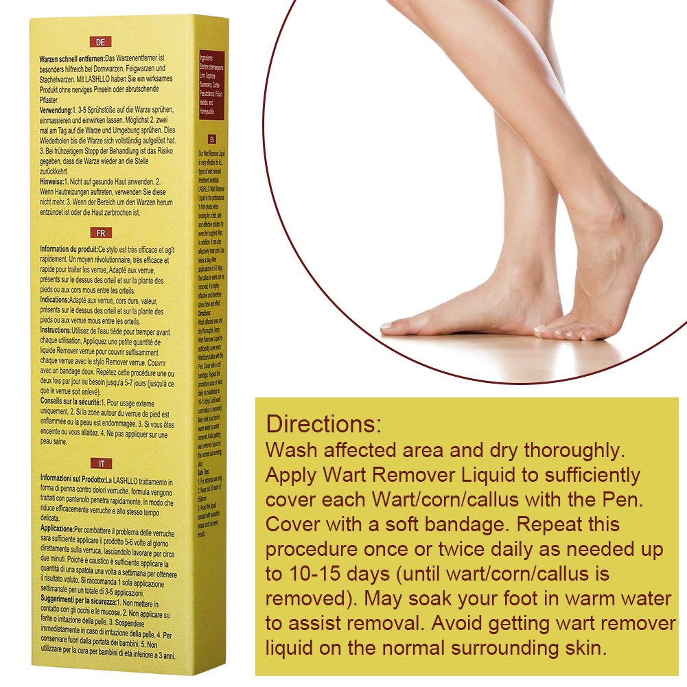 Wart Remover, Plantar Wart Remover, Wart Removal, Corn Remover, Wart ...