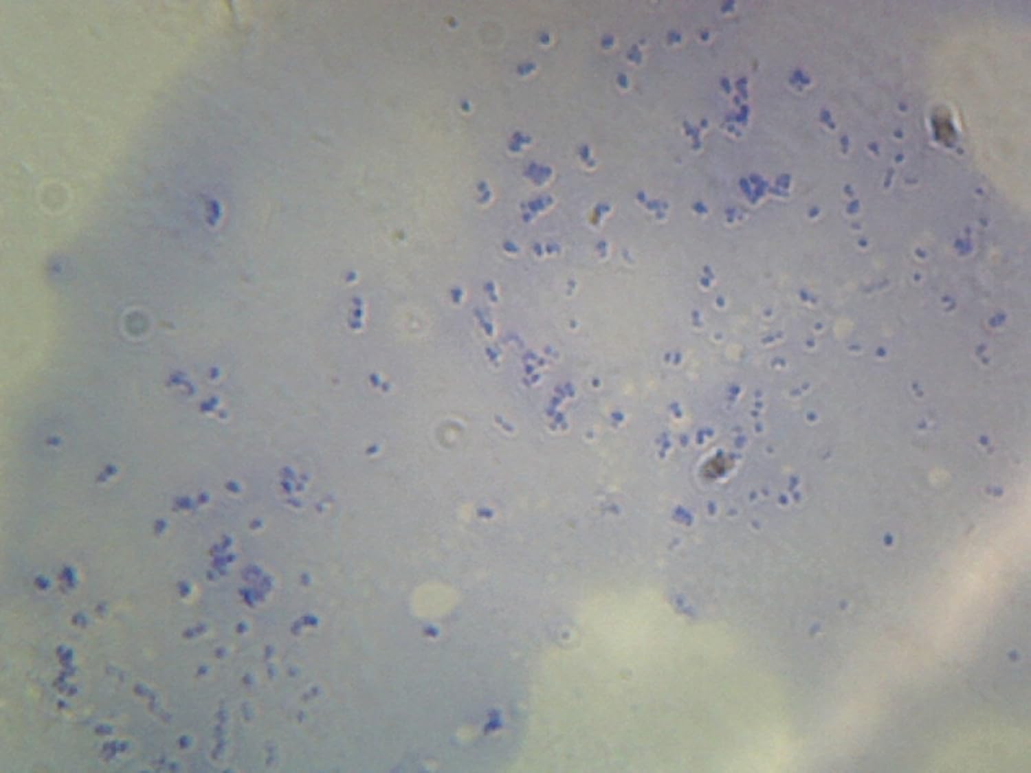 Lactobacillus In Yogurt Light Microscope Observation Of Both Isolates