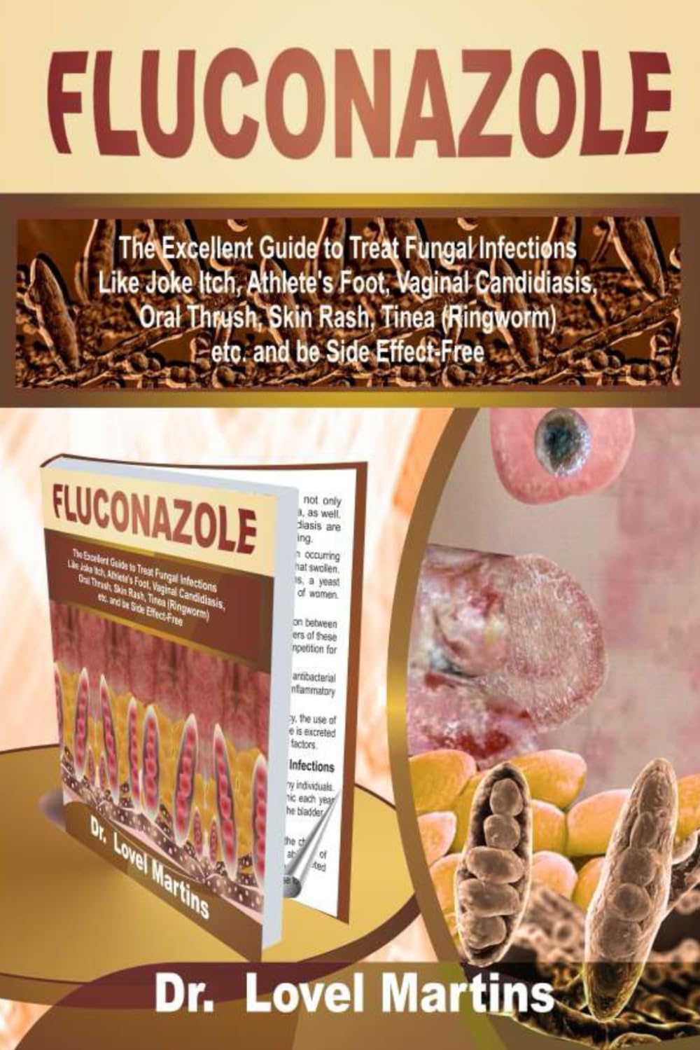 Mua FLUCONAZOLE: The Excellent Guide to Treat Fungal Infections Like ...
