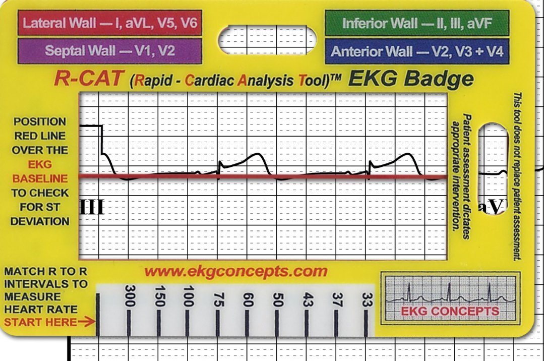 Free printable ekg ruler - polfviva